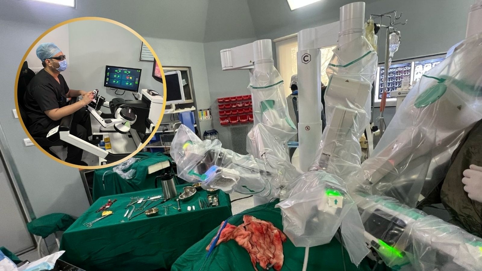 Gujarat's first robotic decortication surgery | ગુજરાતની પ્રથમ રોબોટિક ...